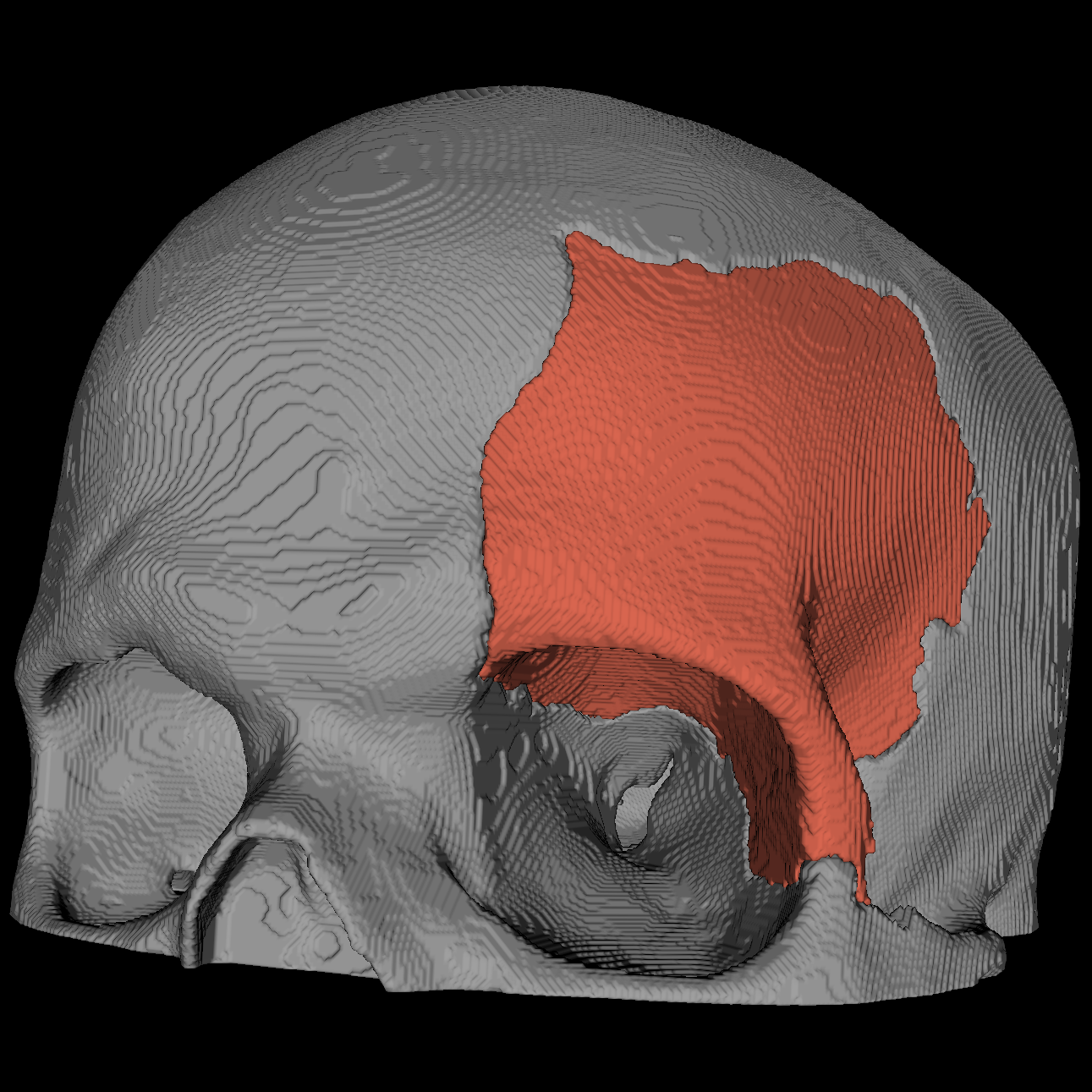 Point Cloud Diffusion Models for Automatic Implant Generation