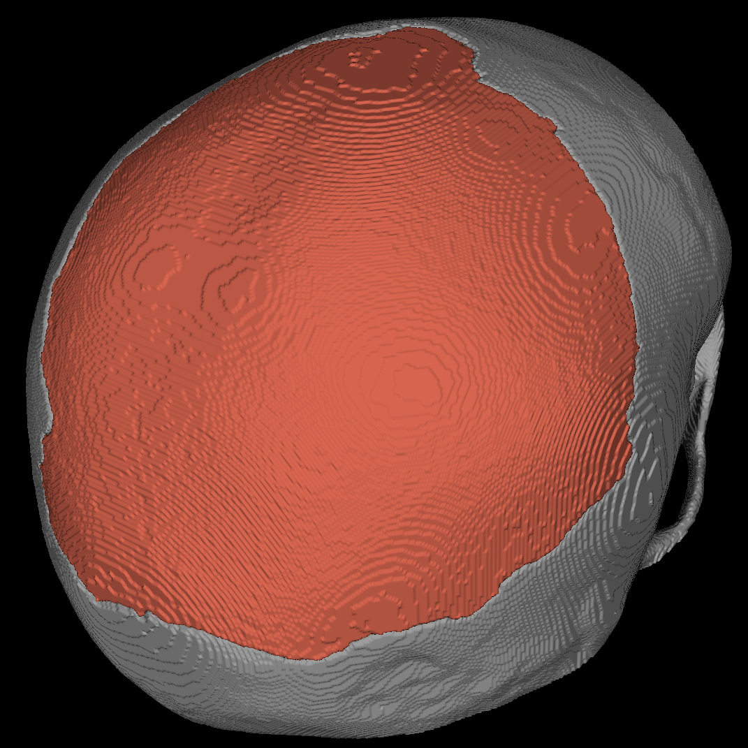 Point Cloud Diffusion Models for Automatic Implant Generation