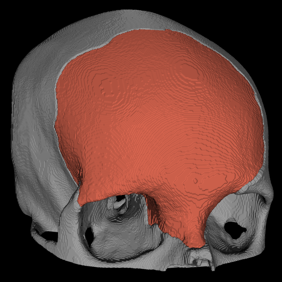 Point Cloud Diffusion Models for Automatic Implant Generation