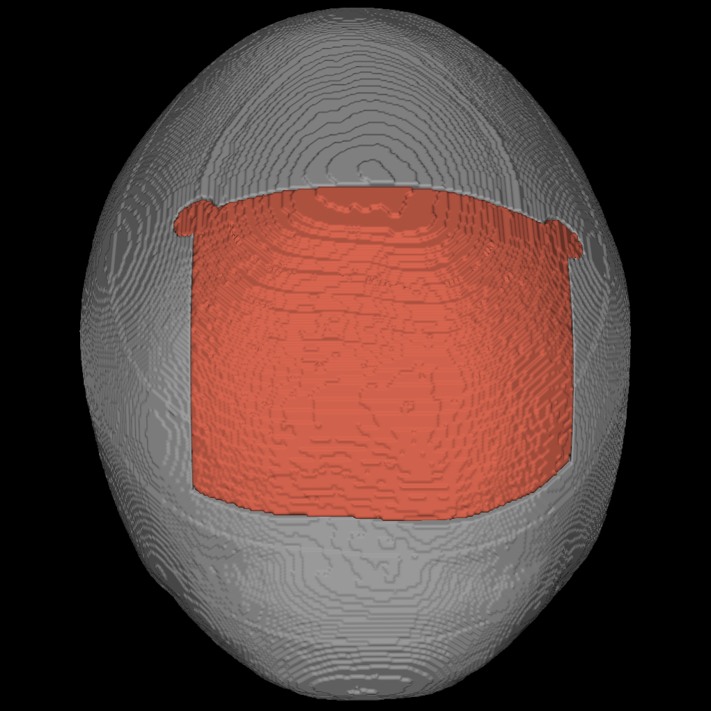 Point Cloud Diffusion Models for Automatic Implant Generation