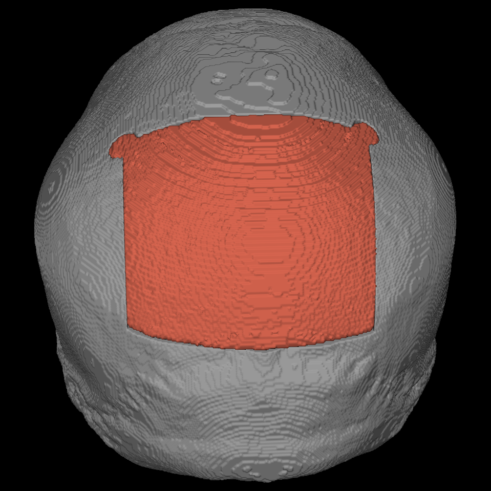 Point Cloud Diffusion Models for Automatic Implant Generation