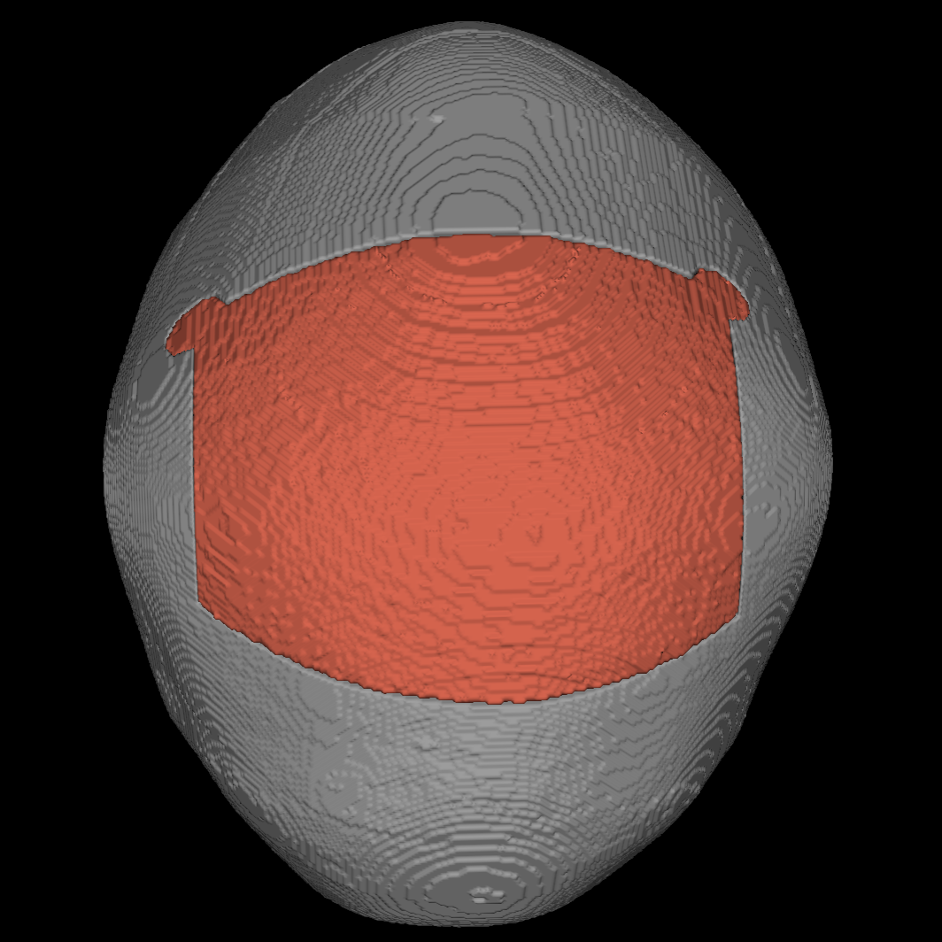 Point Cloud Diffusion Models for Automatic Implant Generation
