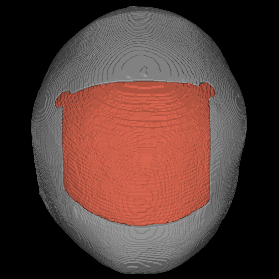 Point Cloud Diffusion Models for Automatic Implant Generation