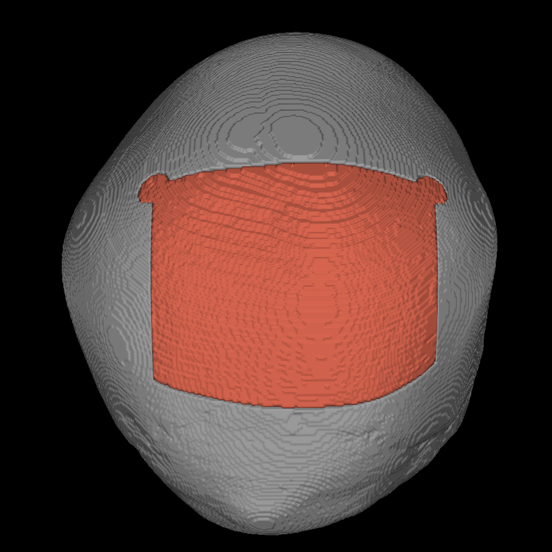 Point Cloud Diffusion Models for Automatic Implant Generation