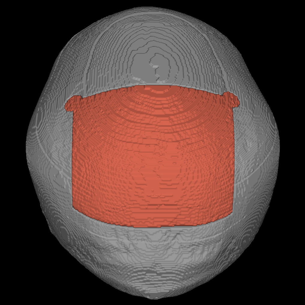 Point Cloud Diffusion Models for Automatic Implant Generation