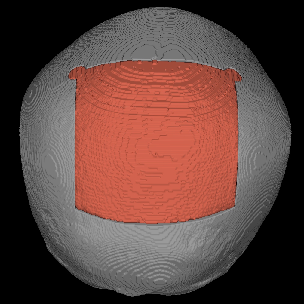 Point Cloud Diffusion Models for Automatic Implant Generation